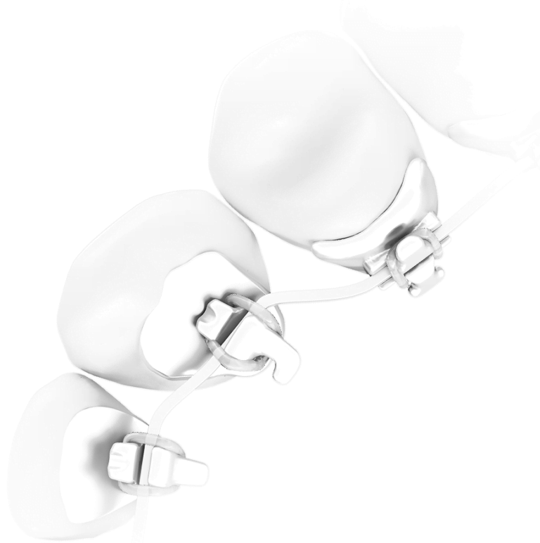 Lingual Braces | Truly Invisible | Twelve Dental | B'ham B2